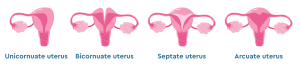 Everything You’ve Wanted To Know About Your Uterus - Axia Women's Health
